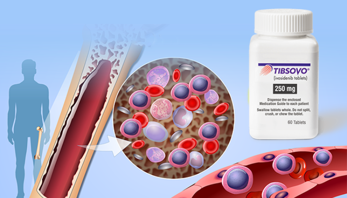 Acute Myeloid Leukaemia treatment earns key rating - Remap Consulting